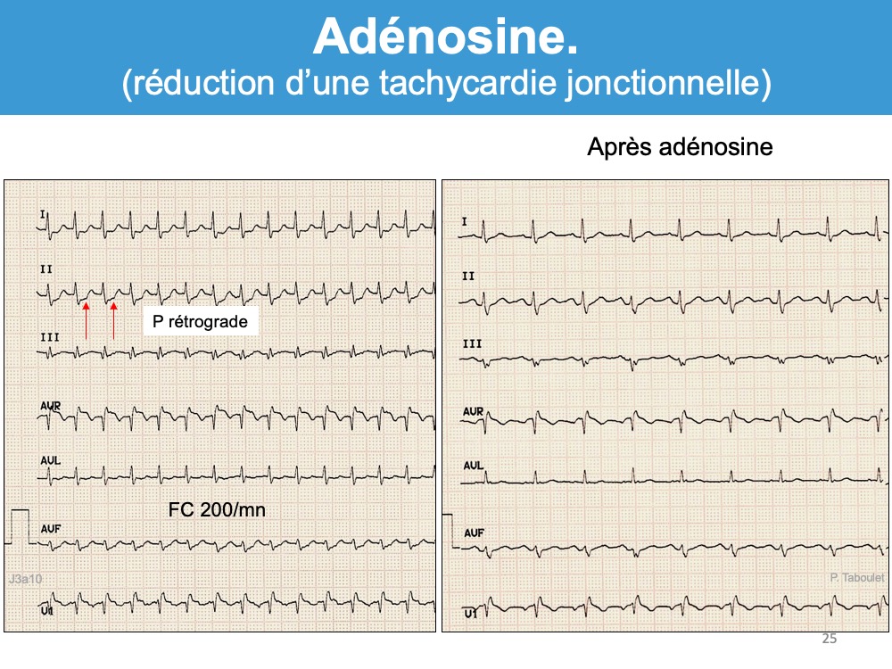 Traitement : e-cardiogram