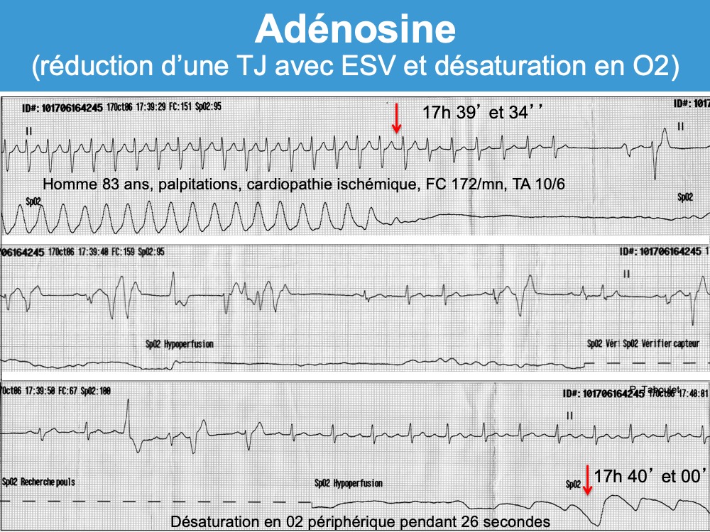 Traitement : e-cardiogram