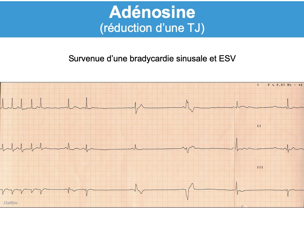 Traitement : e-cardiogram