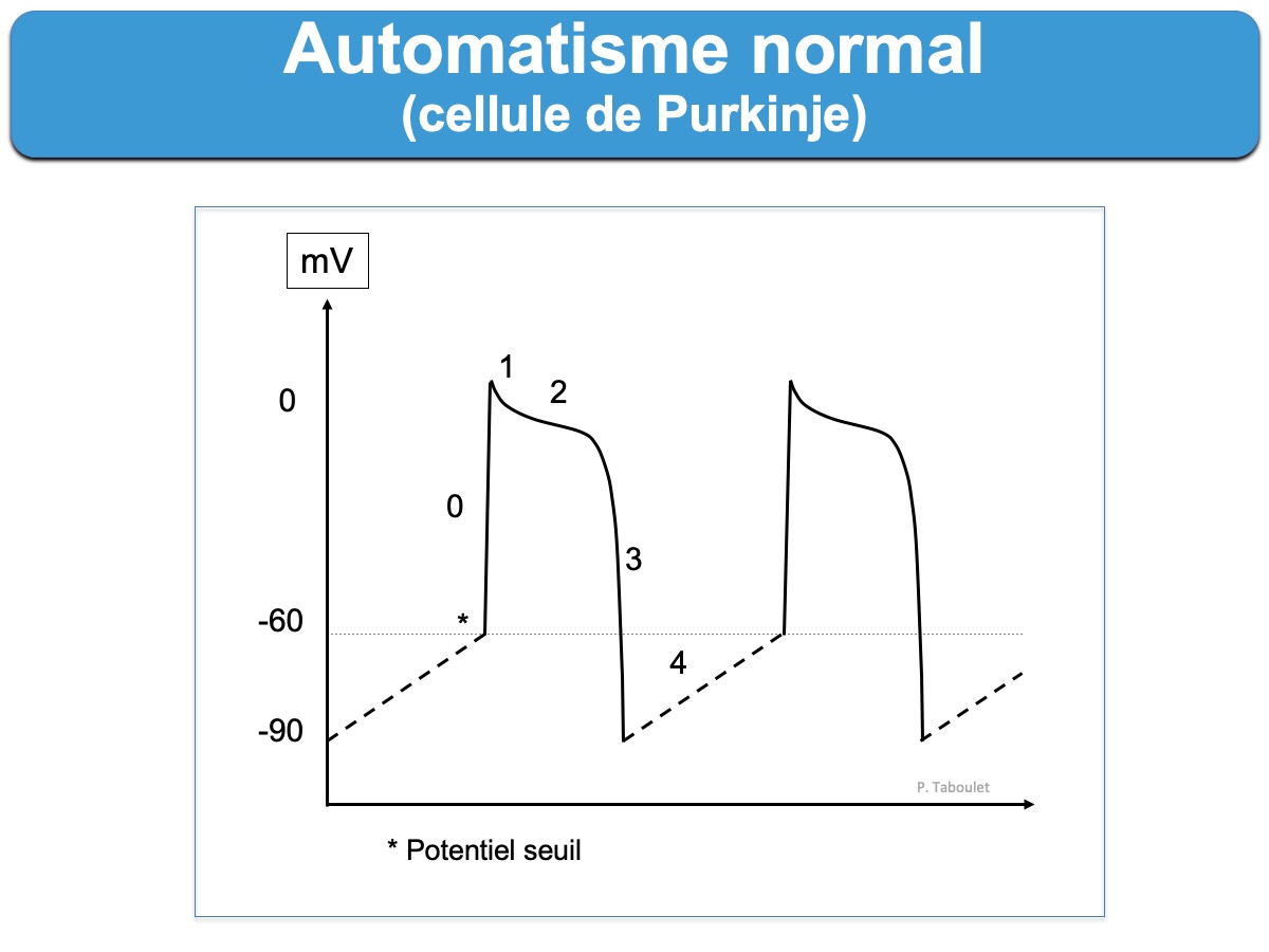 Automatisme : e-cardiogram
