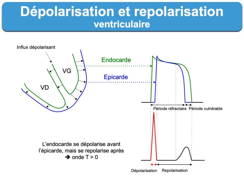 Repolarisation ventriculaire : e-cardiogram