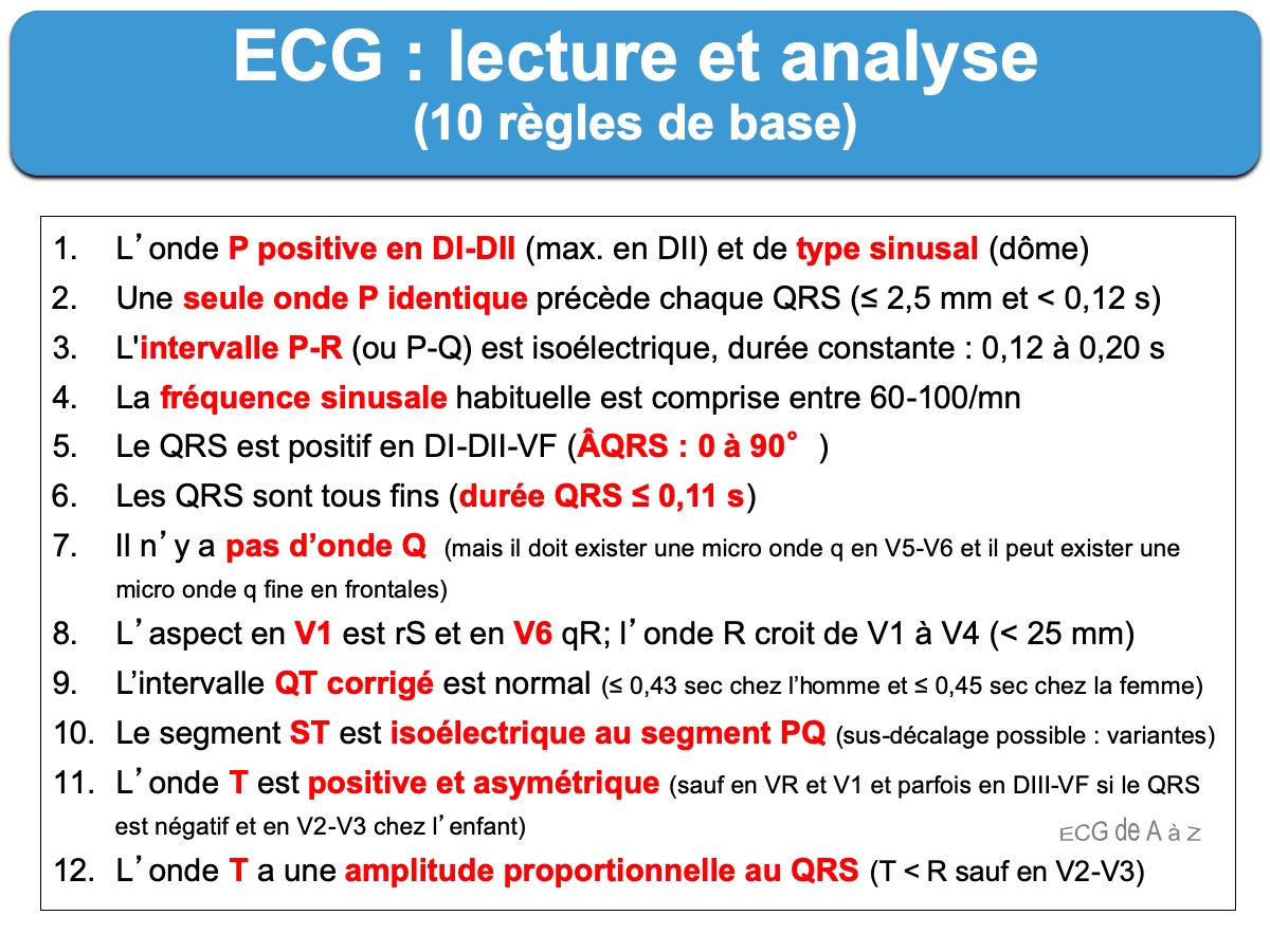 ECG : lecture et analyse : e-cardiogram