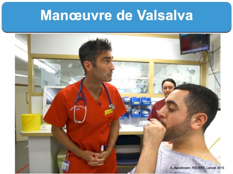 Manœuvres vagales, MSC et Valsalva : e-cardiogram