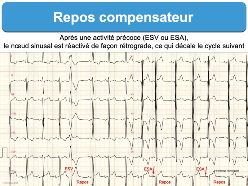 Repos compensateur : e-cardiogram