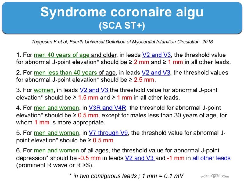SCA 2a. ST+ académiques : e-cardiogram