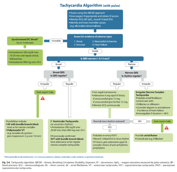 Tachycardie : e-cardiogram