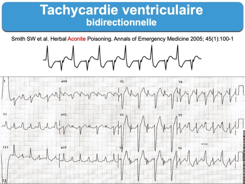 TV 6. bidirectionnelle : e-cardiogram