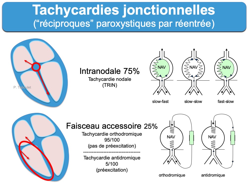 TJ 1. généralités : e-cardiogram