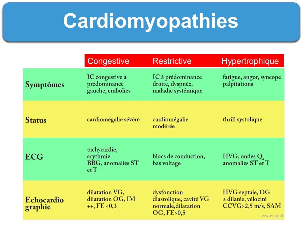 Cardiopathie : e-cardiogram