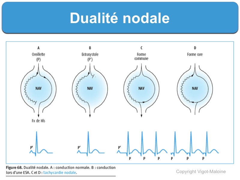 Dualité nodale : e-cardiogram