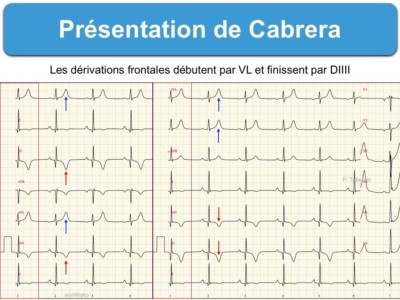 Présentation de Cabrera : e-cardiogram