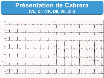 Présentation de Cabrera : e-cardiogram