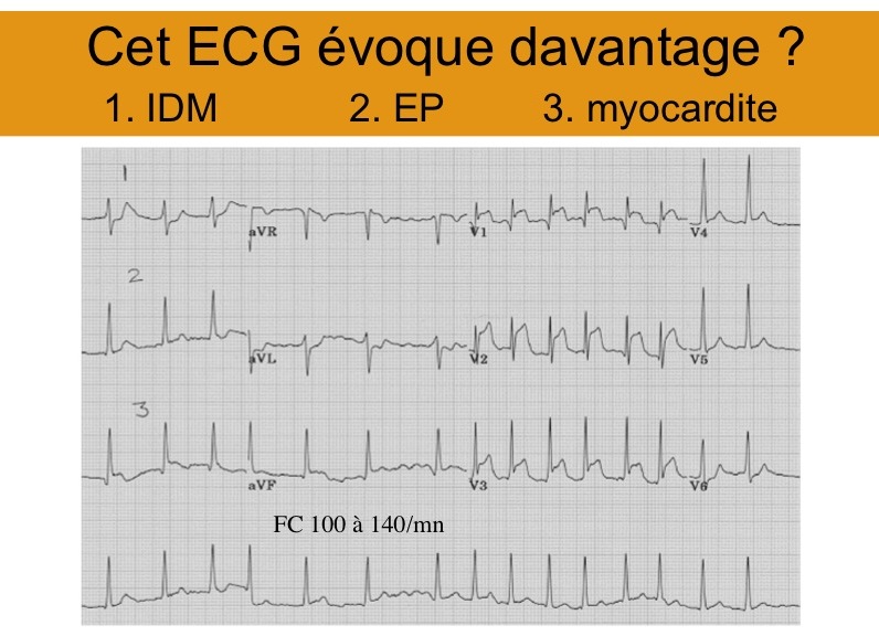 Quiz : Page 82 sur 111 : e-cardiogram