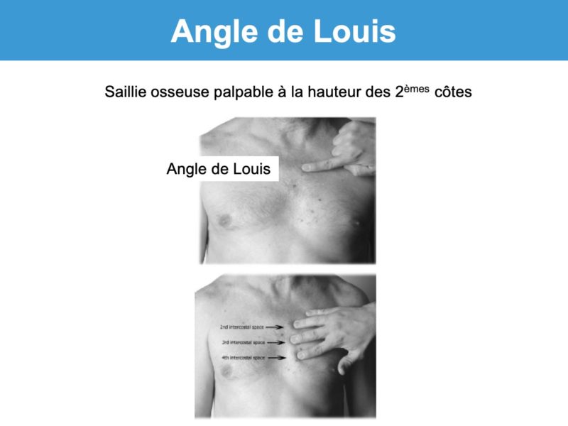 Angle de Louis : e-cardiogram