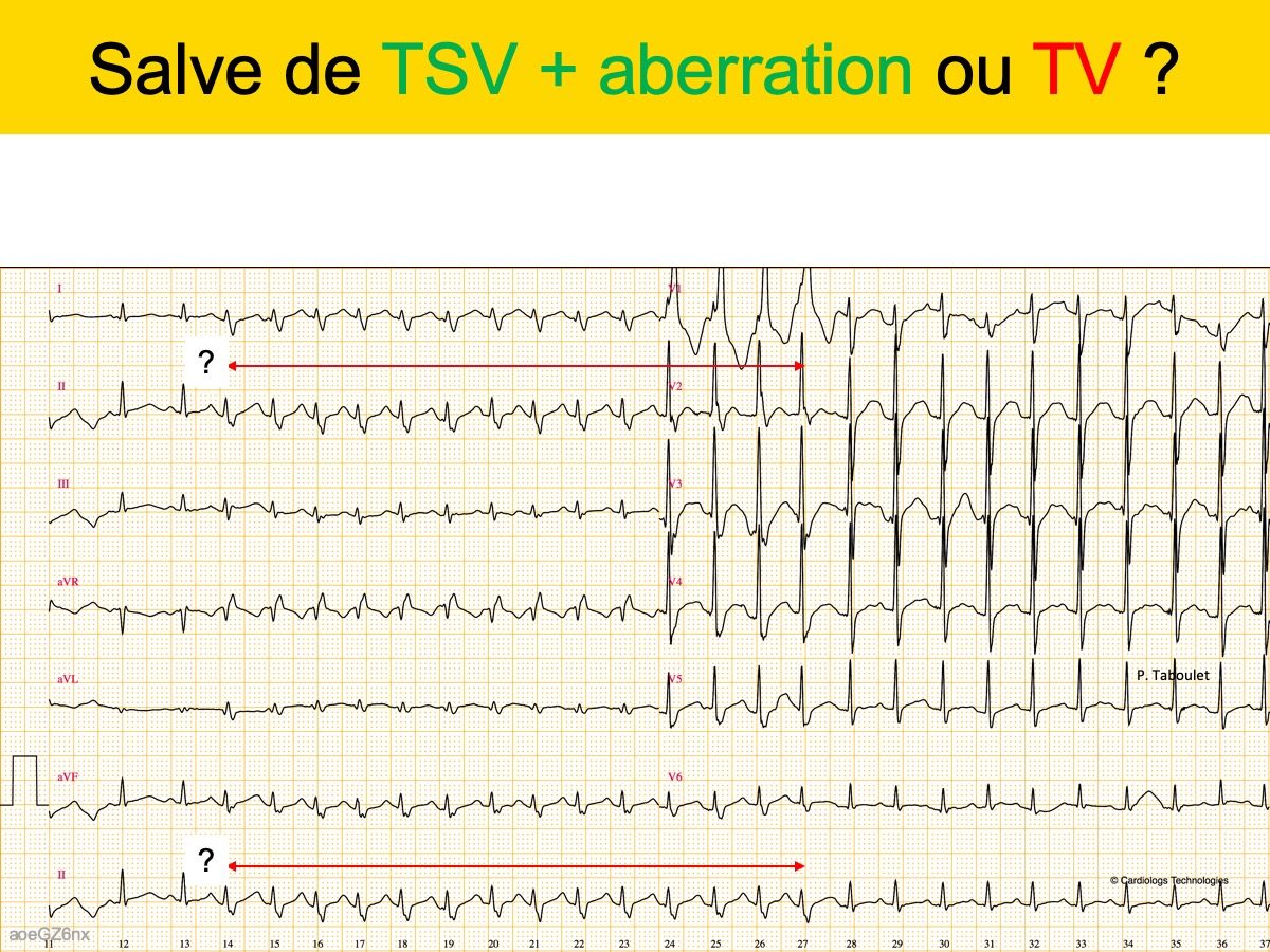 Bienvenu(e)s dans ECG-LAND ! : e-cardiogram