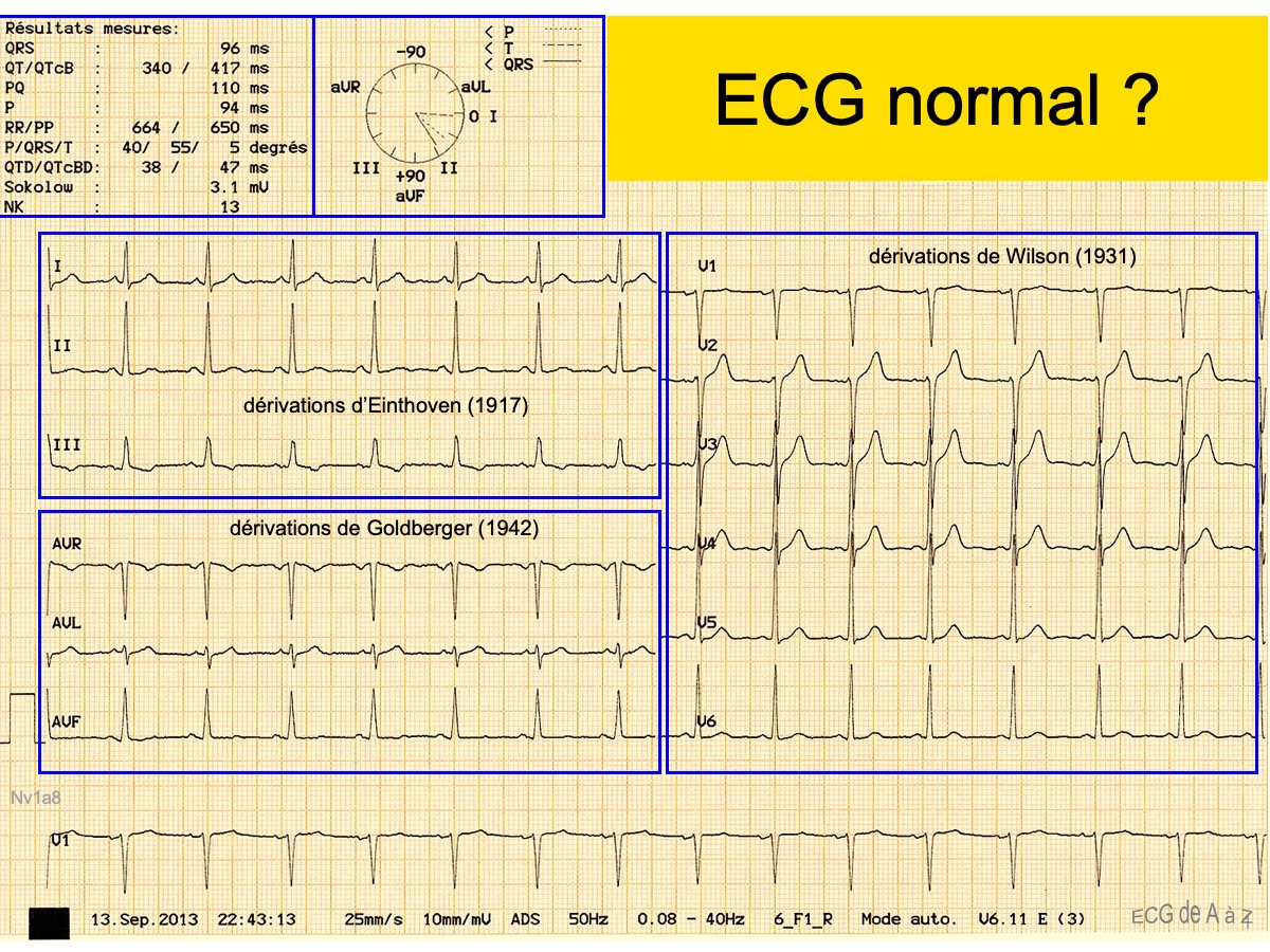 Quiz Evaluation générale 1 (libre accès) : e-cardiogram