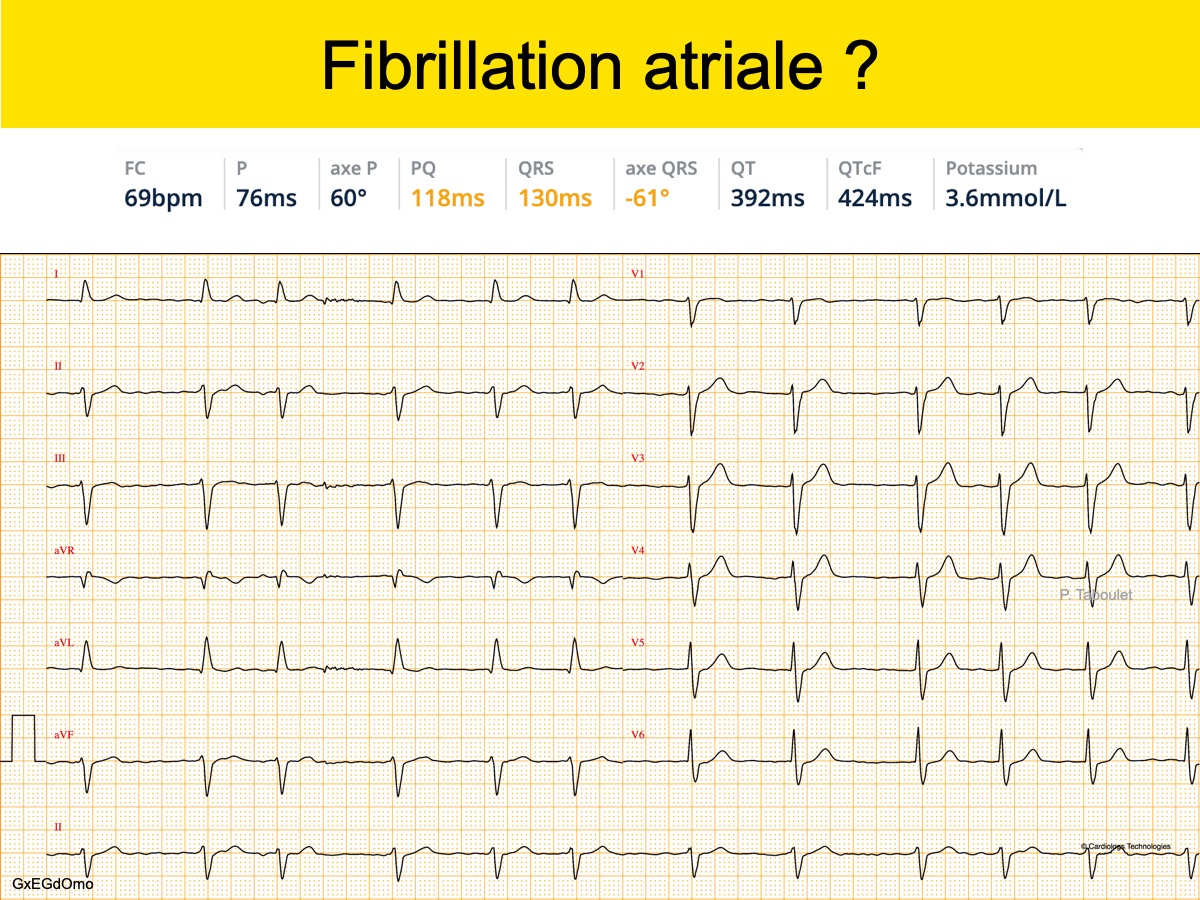 Quiz Evaluation générale 1 (libre accès) : e-cardiogram