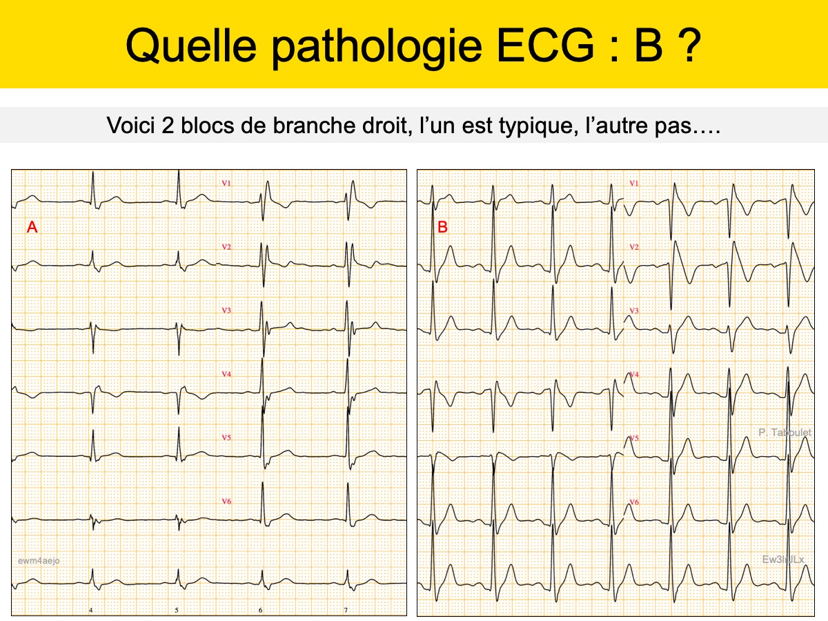 Quiz Evaluation générale 1 (libre accès) : e-cardiogram