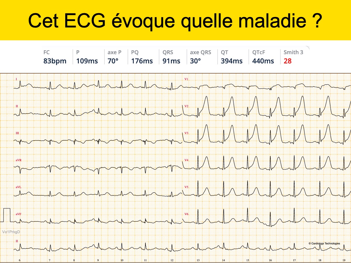 Quiz Evaluation générale 1 (libre accès) : e-cardiogram