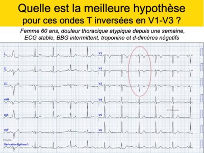 Bienvenu(e)s dans ECG-LAND ! : e-cardiogram