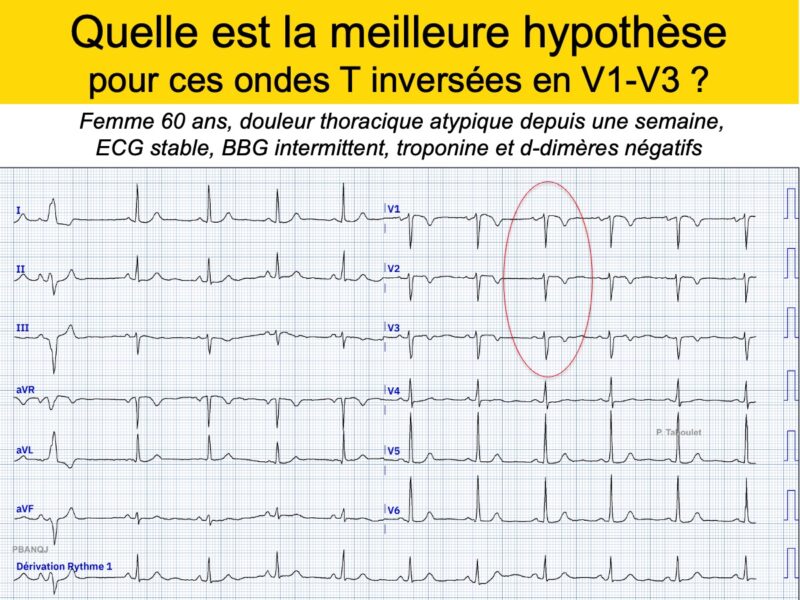 Bienvenu(e)s dans ECG-LAND ! : e-cardiogram