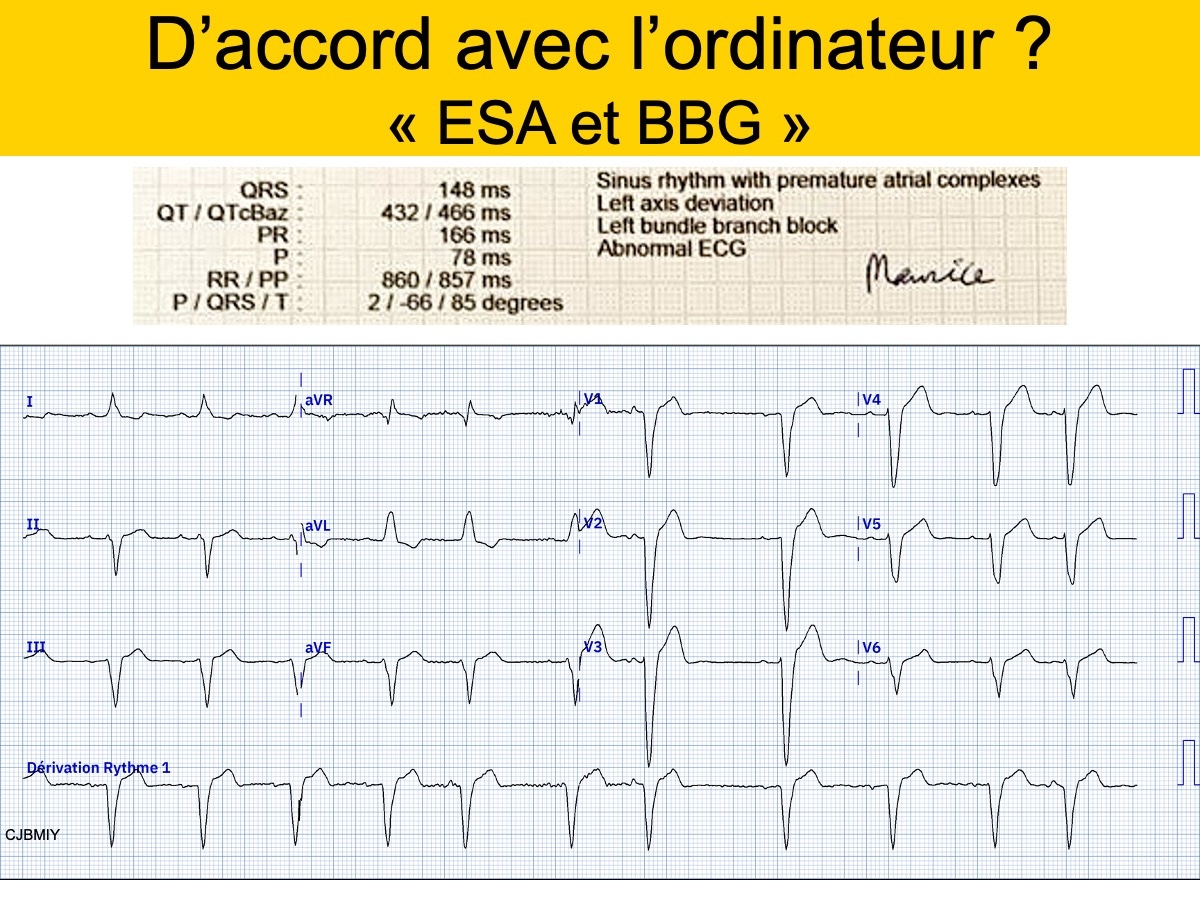 Physiologie : Page 8 sur 18 : e-cardiogram